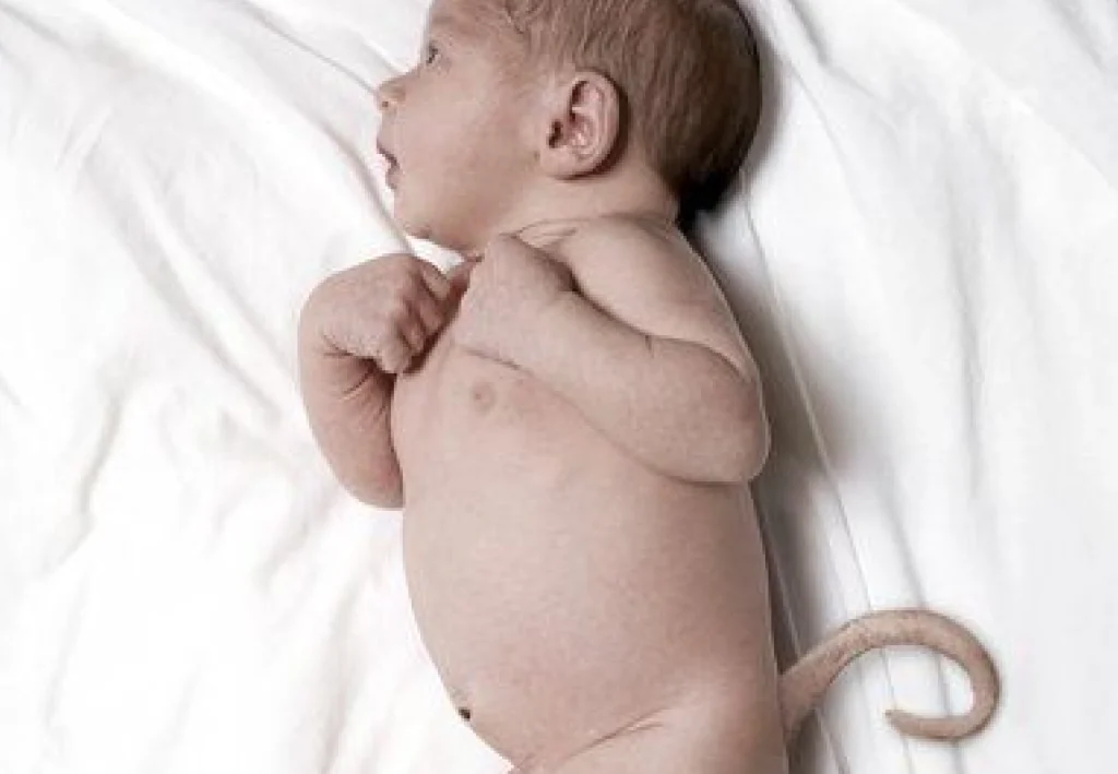 Humans Have Secret Stripes: Hidden Skin Patterns Explained